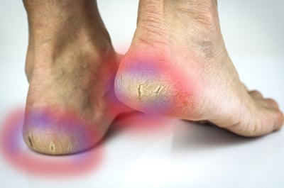 Family Wellness Footcare and Orthotics – Tony Hu D.POD.M. Chiropodist